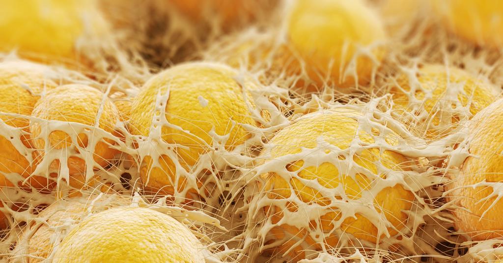 Mesothelial cells in omental adipose tissue hinder adipogenesis | News ...