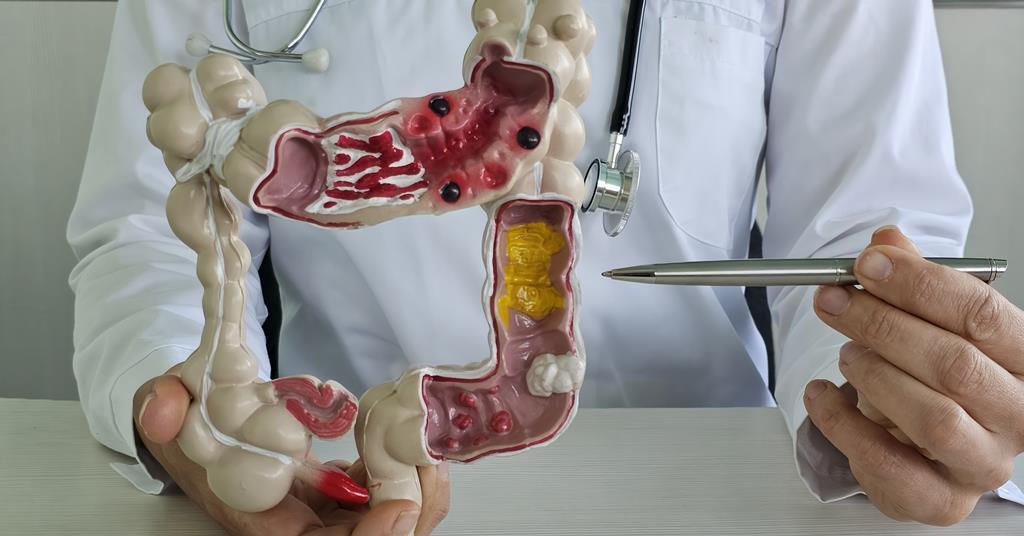 Ferroptosis targets treatment-resistant digestive cancers | Drug Target ...