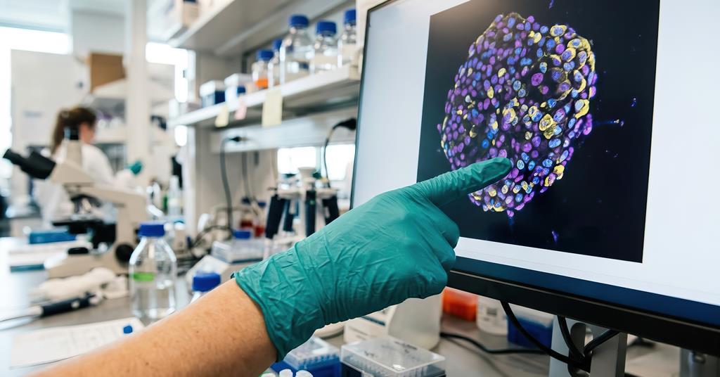 How organoids and iPSCs are improving drug discovery models | Drug ...