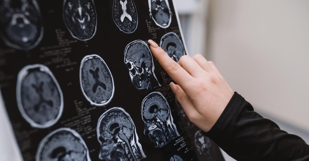 Copper drug Cu(ATSM) reduces Alzheimer's proteins by 42 percent in ...
