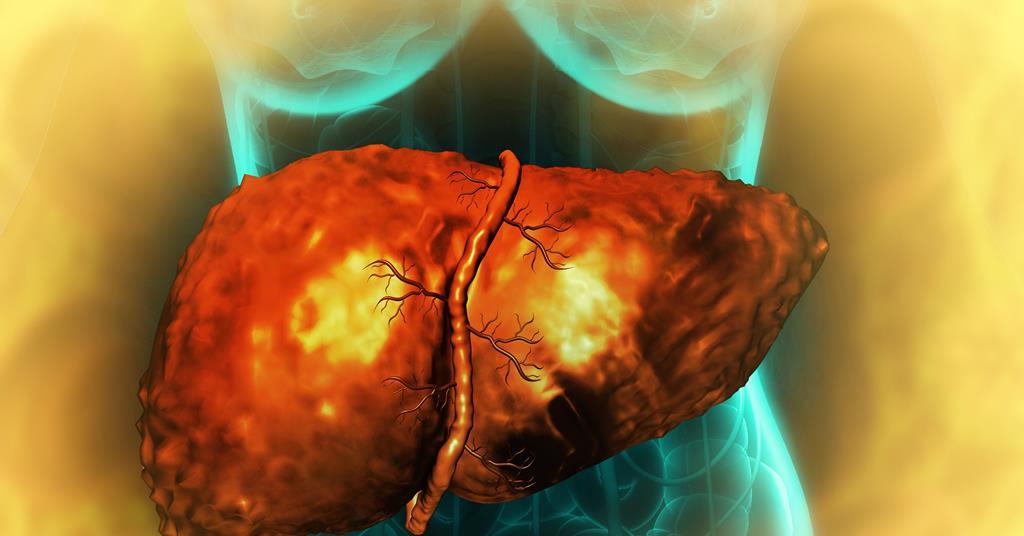 Multiplex immunofluorescence workflow enables accessible spatial ...