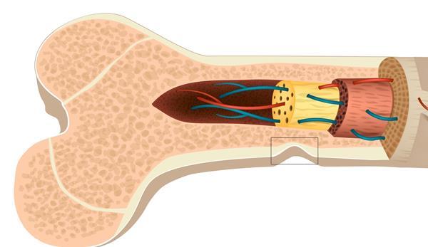 Notch2 signalling pathway enables breast cancer dormancy in bone marrow ...