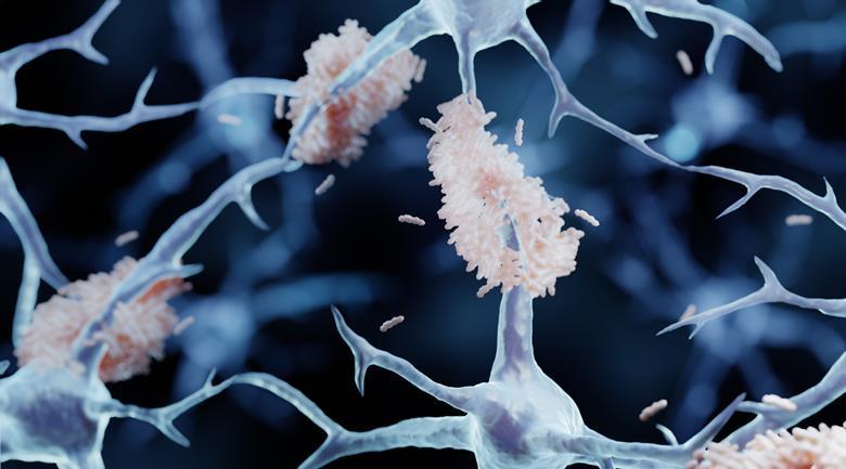Beyond tangles: why soluble intracellular tau should guide drug ...